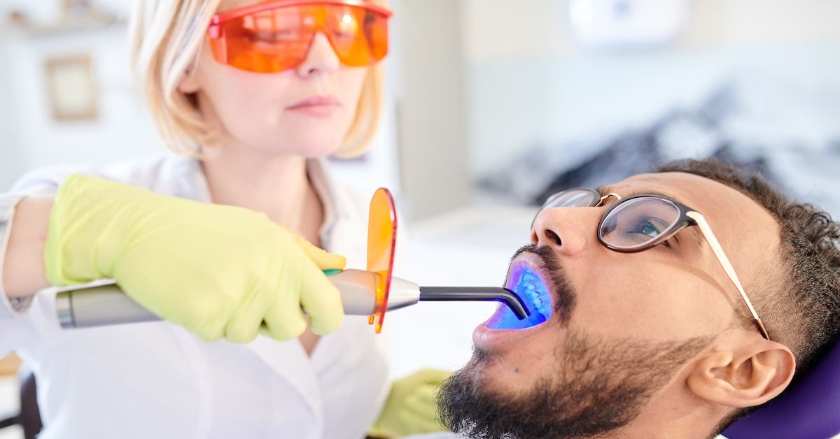 What is composite dental bonding? Procedure & cost 🦷