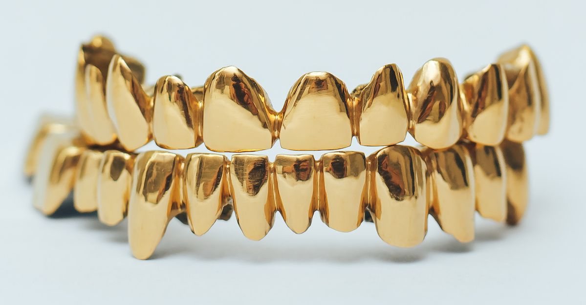Teeth grillz: what they are, types and prices 🦷