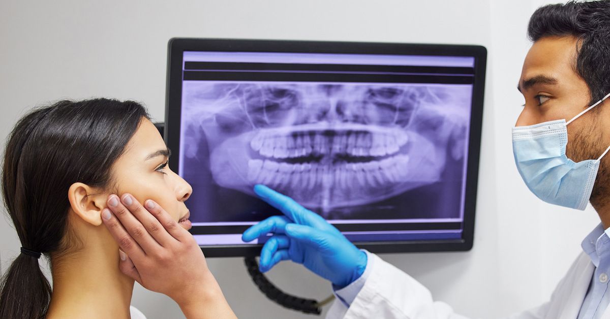 What are wisdom teeth and why do some require removal? 🦷