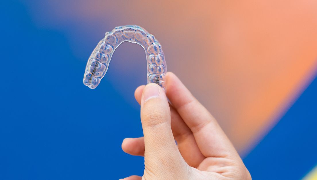 Postratamiento Impress: Dientes alineados para siempre 🦷